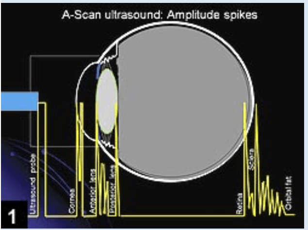medical ultrasound A-scan probe for for eye scanning from China ...